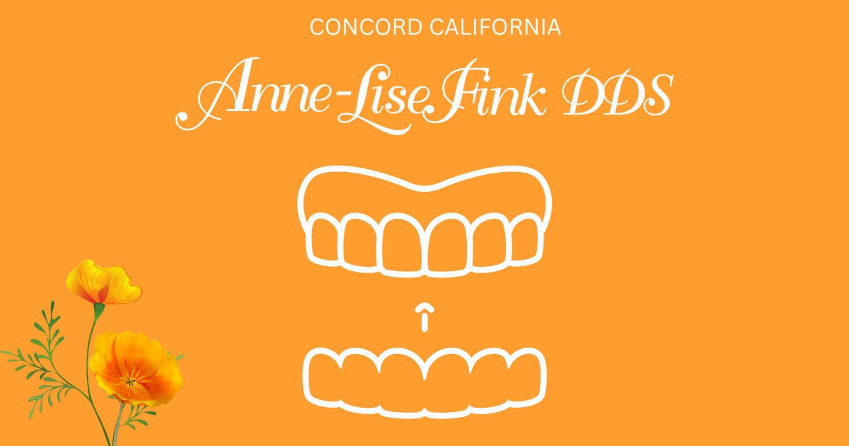 Invisalign® — Concord's Choice for Invisalign® — Dr. Fink Concord, CA